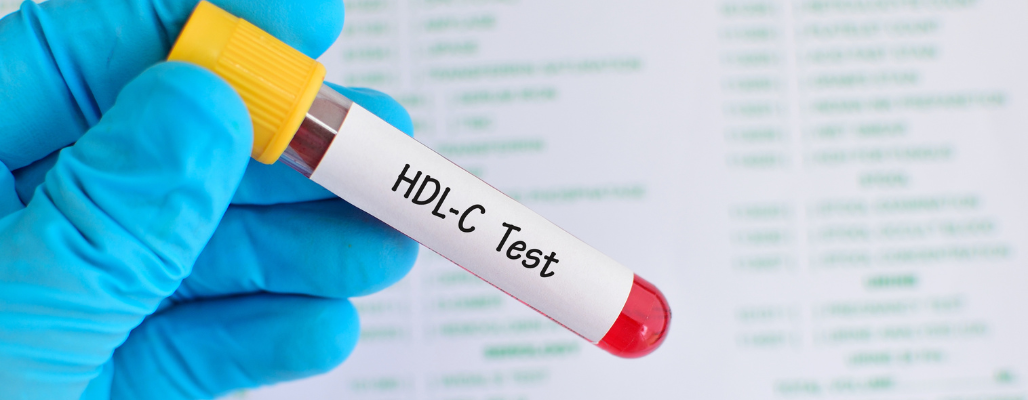 HDL el mejor aliado contra el Alzheimer