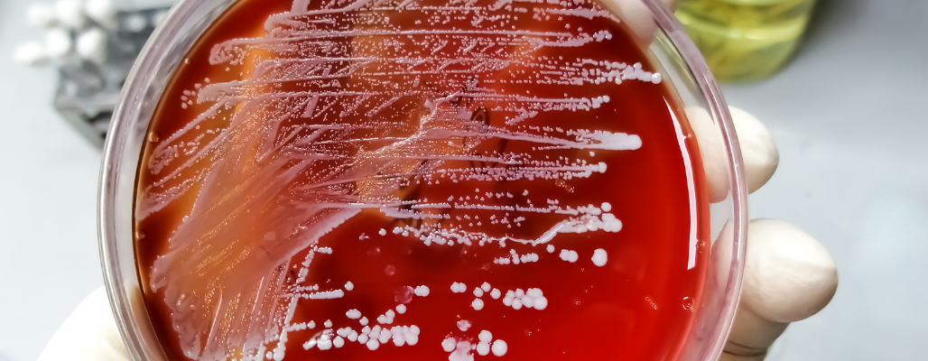 Agar agar: el sustituto vegano de la gelatina que promueve la saciedad ...